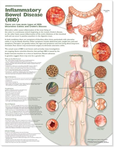 Gastroenterology 4 Chart Set Gastoesophageal Disorders And Digestive ...