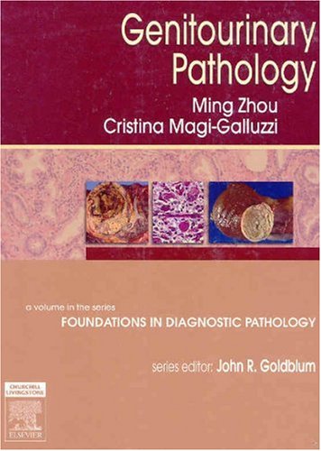 Genitourinary Pathology: A Volume in Foundations in Diagnostic ...