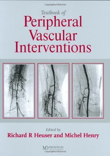 Textbook of Peripheral Vascular Interventions: Heuser, Richard R ...