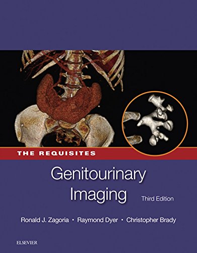Genitourinary Imaging: The Requisites E-Book (Requisites in Radiology ...