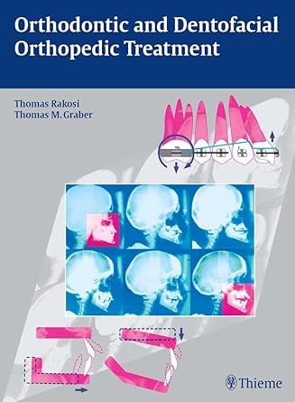 Orthodontic and Dentofacial Orthopedic Treatment eBook : Rakosi, Thomas ...