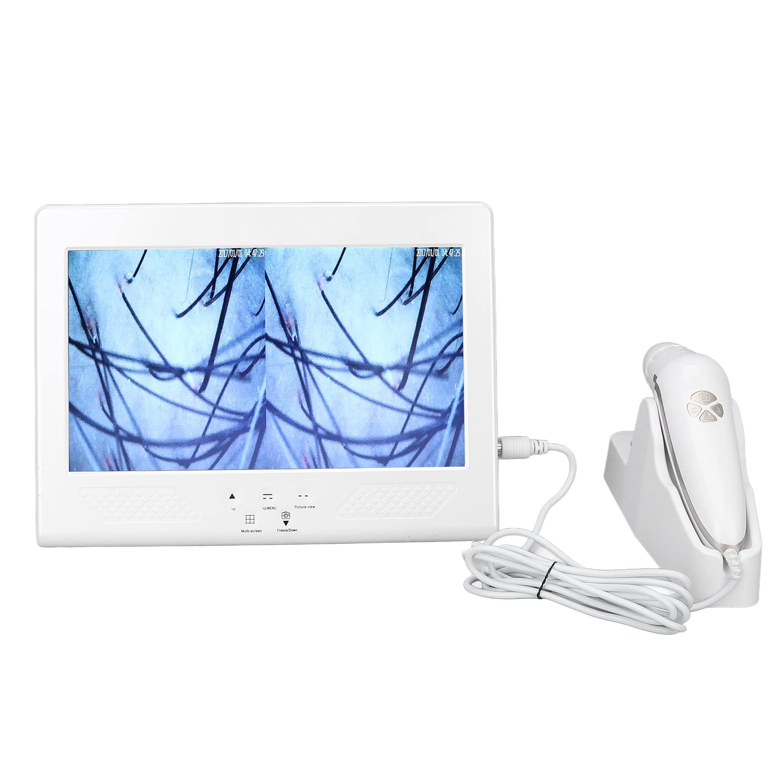 Buy Skin Diagnosis Hair Analyzer 12inch Skin Hair Detector Analyser ...