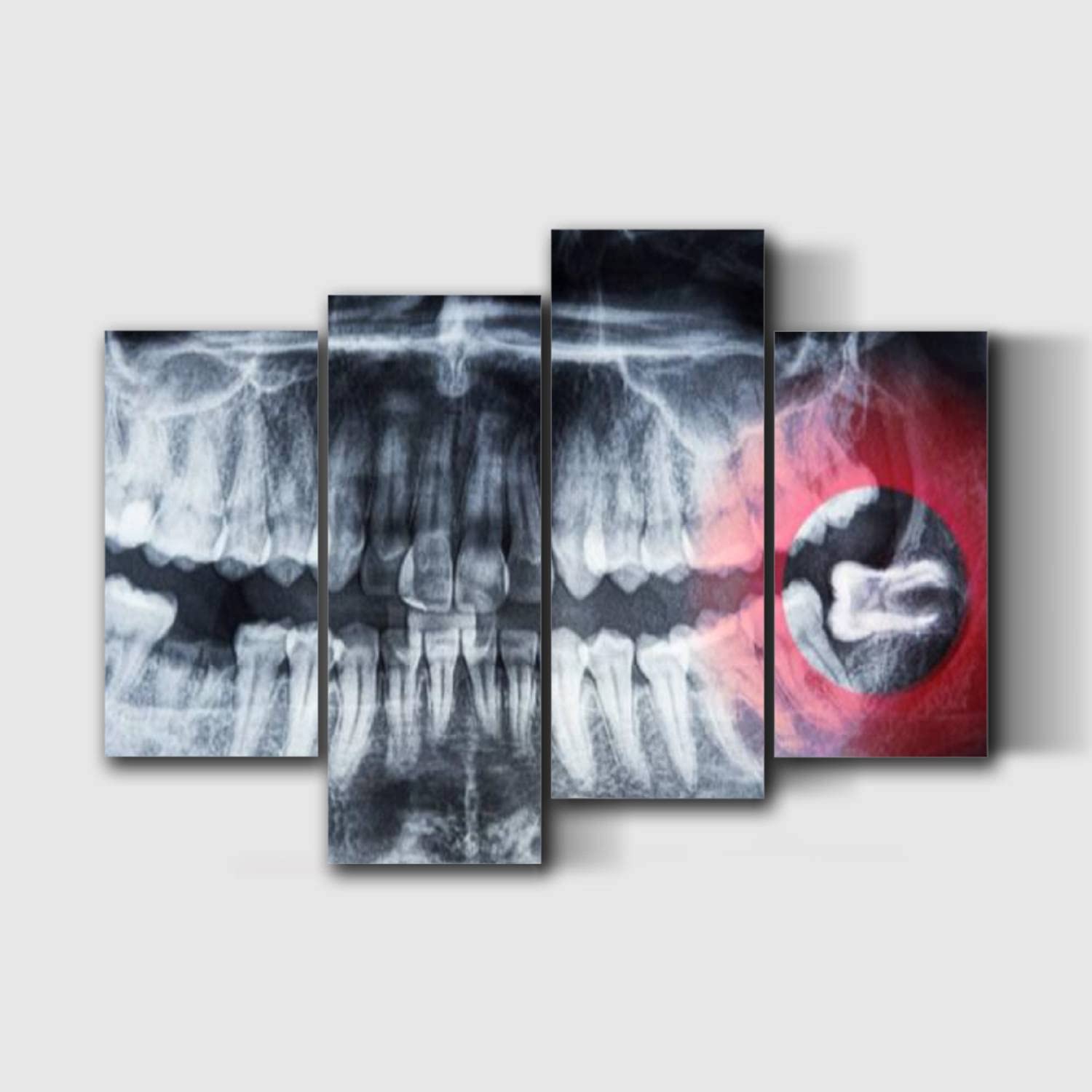 Wisdom Tooth Art