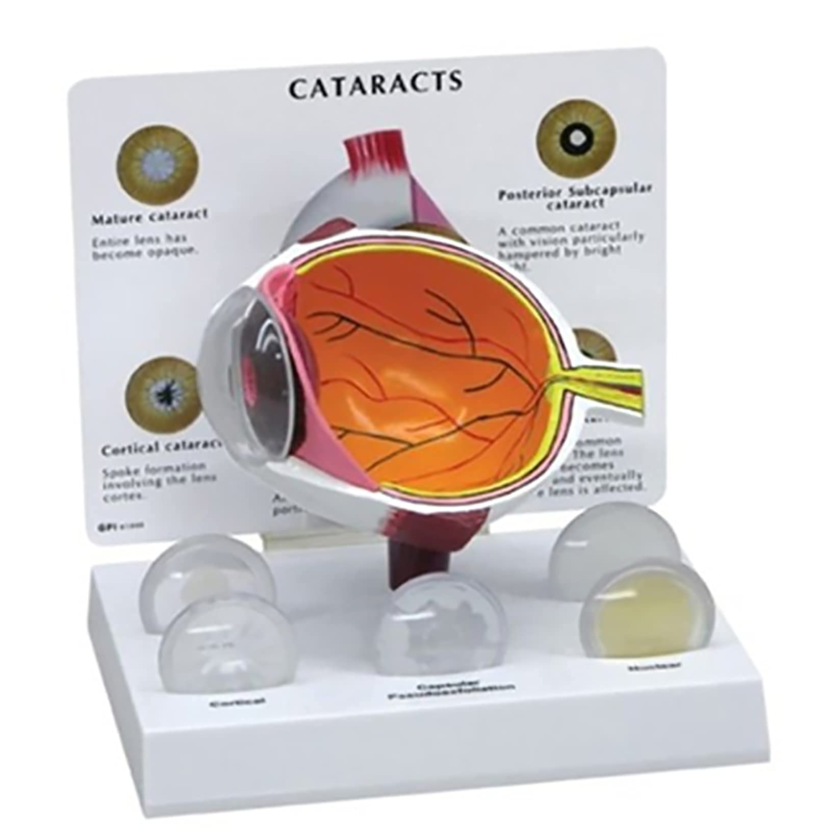 Xhllx Human Anatomy Eye Template Cataract Eye Model Replica Anatomy ...