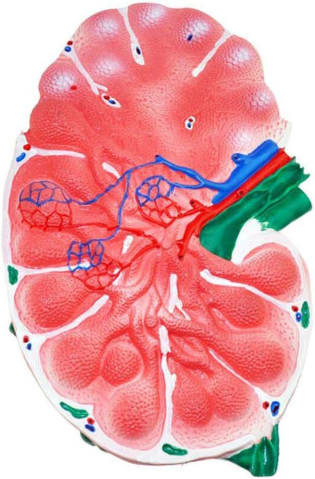 Amazon.com: Anatomy Model Lymph Node Model Teaching Medical Model ...