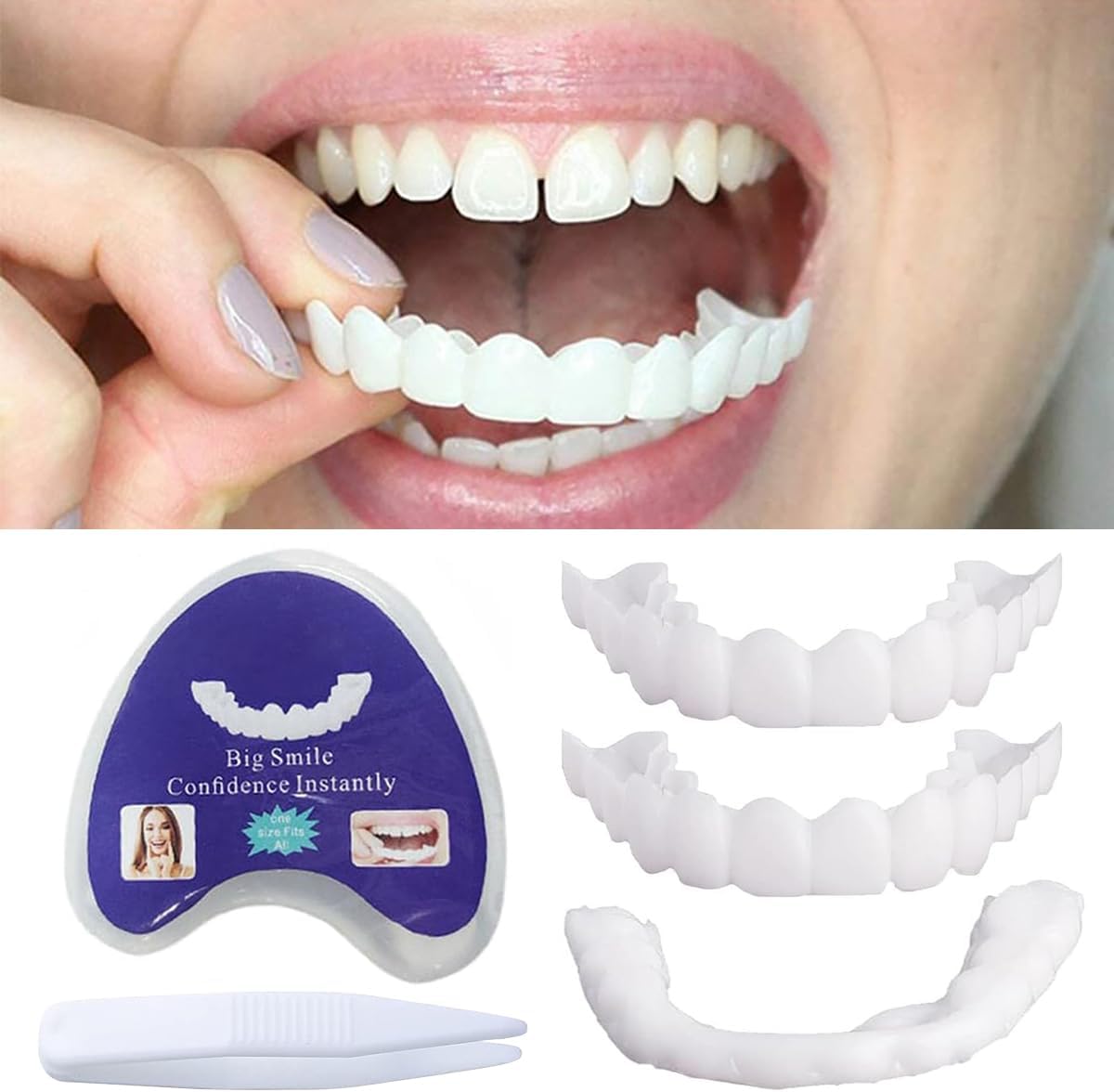 Gavilion Snap-on Silicone Denture Veneers for Confident Smile