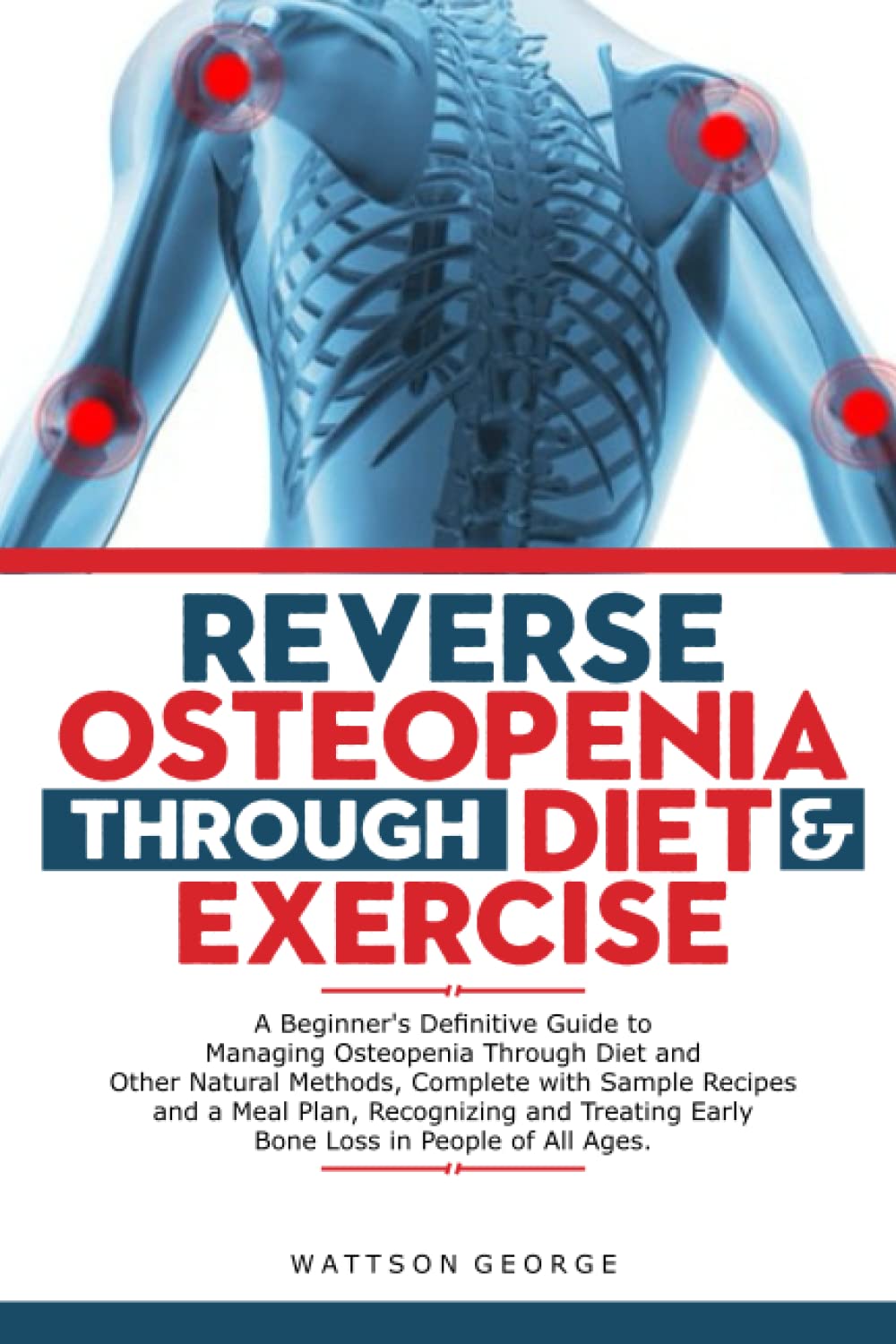 REVERSE OSTEOPENIA THROUGH DIET AND EXERCISE: A Beginner's Definitive ...