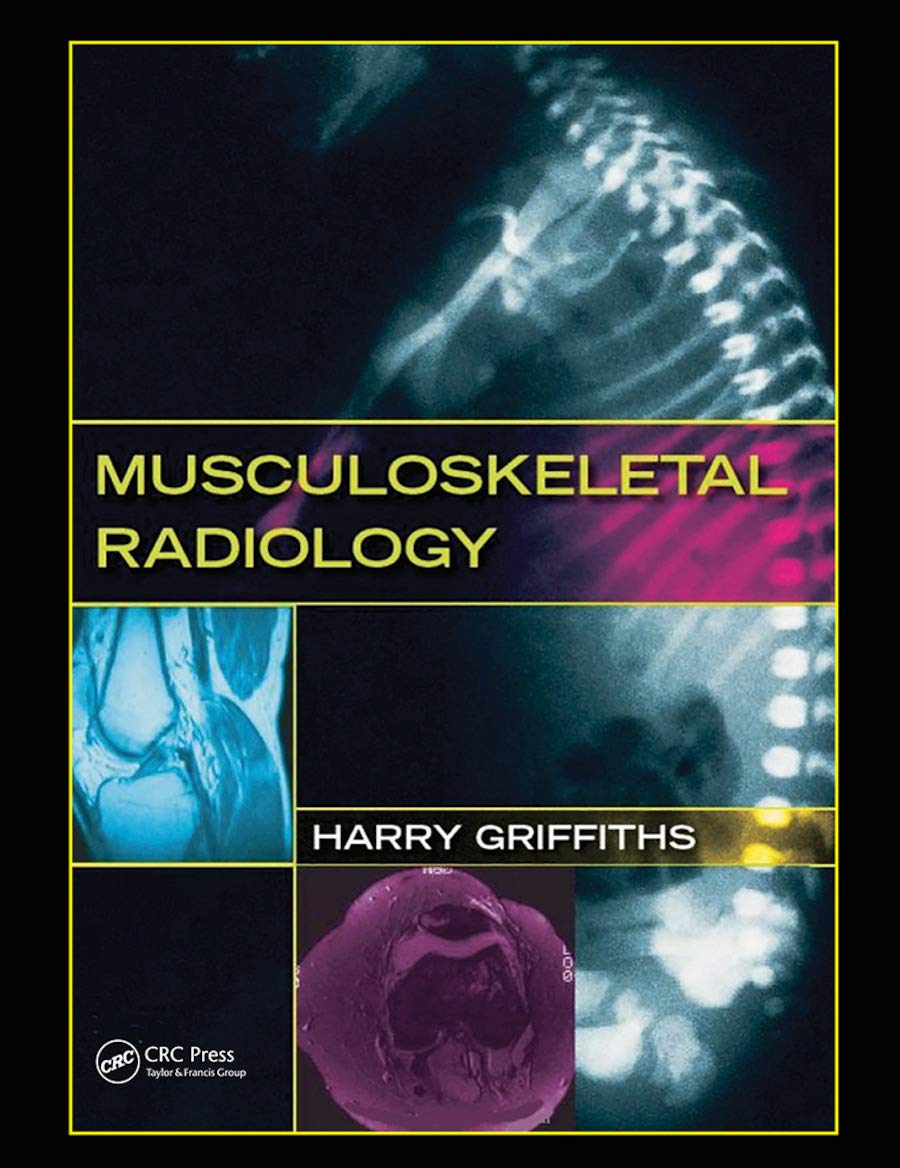 Buy Musculoskeletal Radiology Book Online at Low Prices in India ...