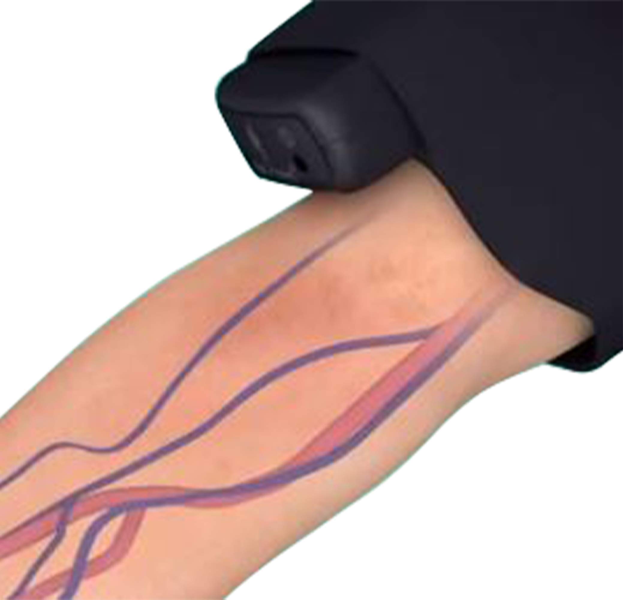 Fist Assist Device: Arm Vein Health Enhancement - Circulation Vein ...