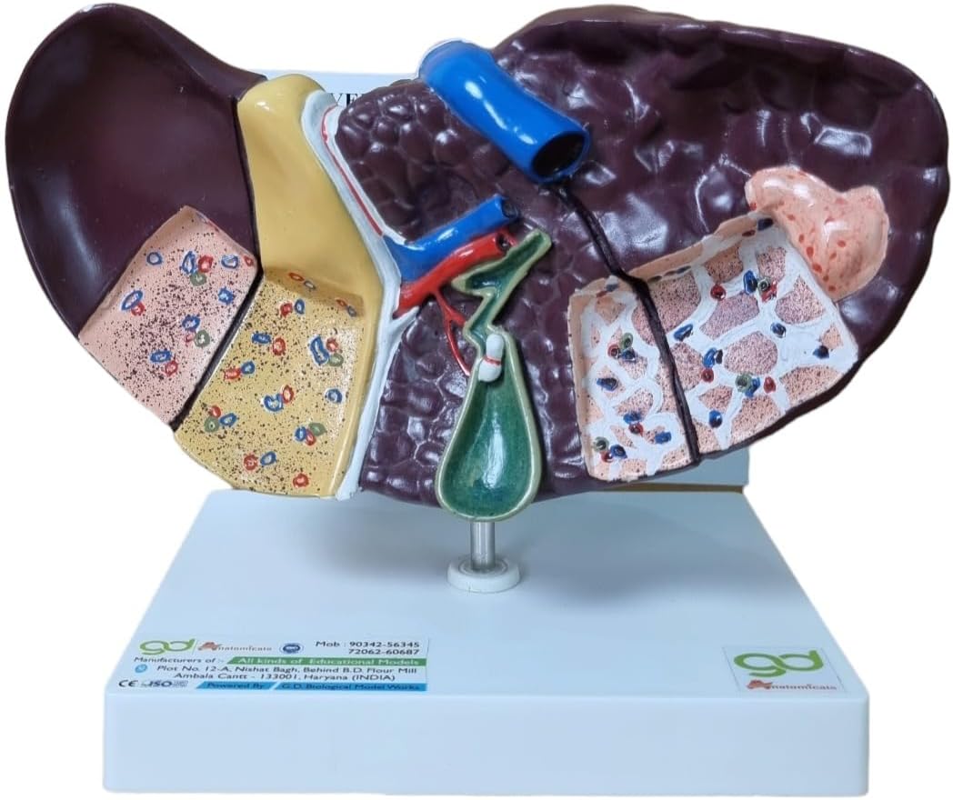 GD ANATOMICALS ® Human Body Anatomy Liver Model with Pathologies ...