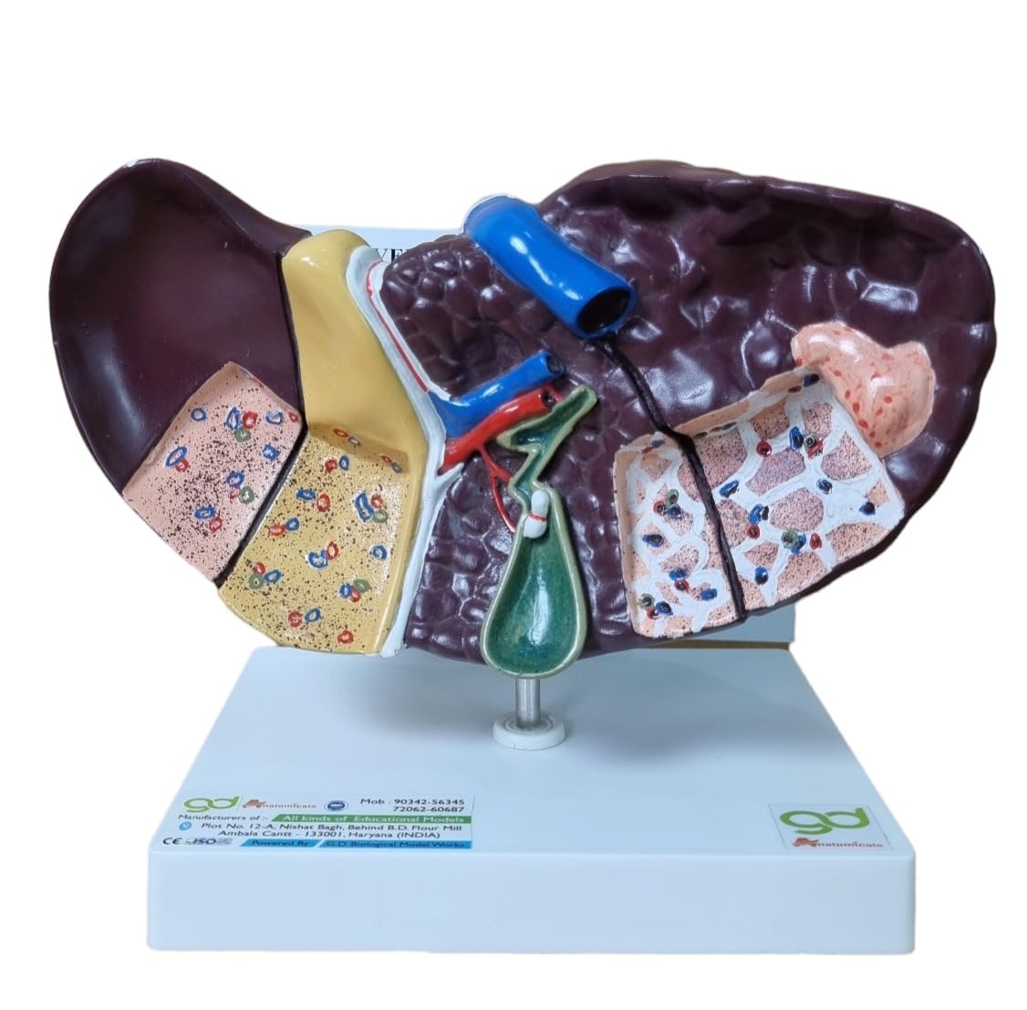 GD ANATOMICALS ® Human Body Anatomy Liver Model with Pathologies ...