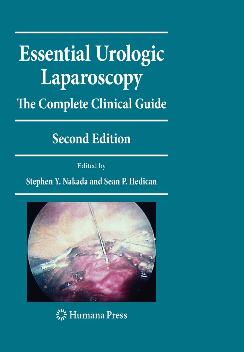 Buy Essential Urologic Laparoscopy: The Complete Clinical Guide ...
