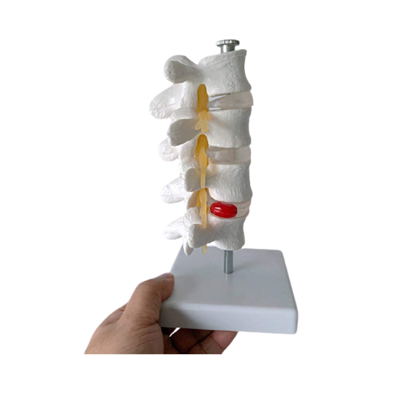 Buy XIEZI Anatomical Model Lumbar Disc Herniation Demonstration Model ...