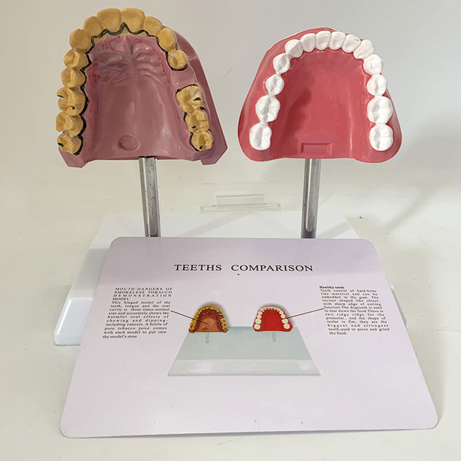 Buy Teeth Dental Demonstration Model Oral Care Patient Education ...