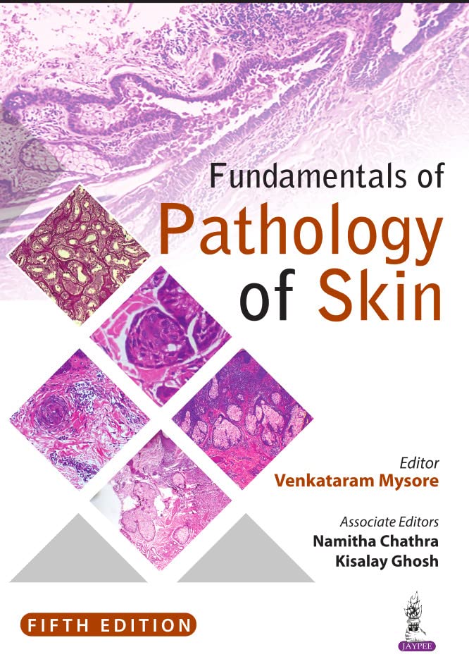 Fundamentals of Pathology of Skin eBook : Mysore, Venkataram; Chathra ...