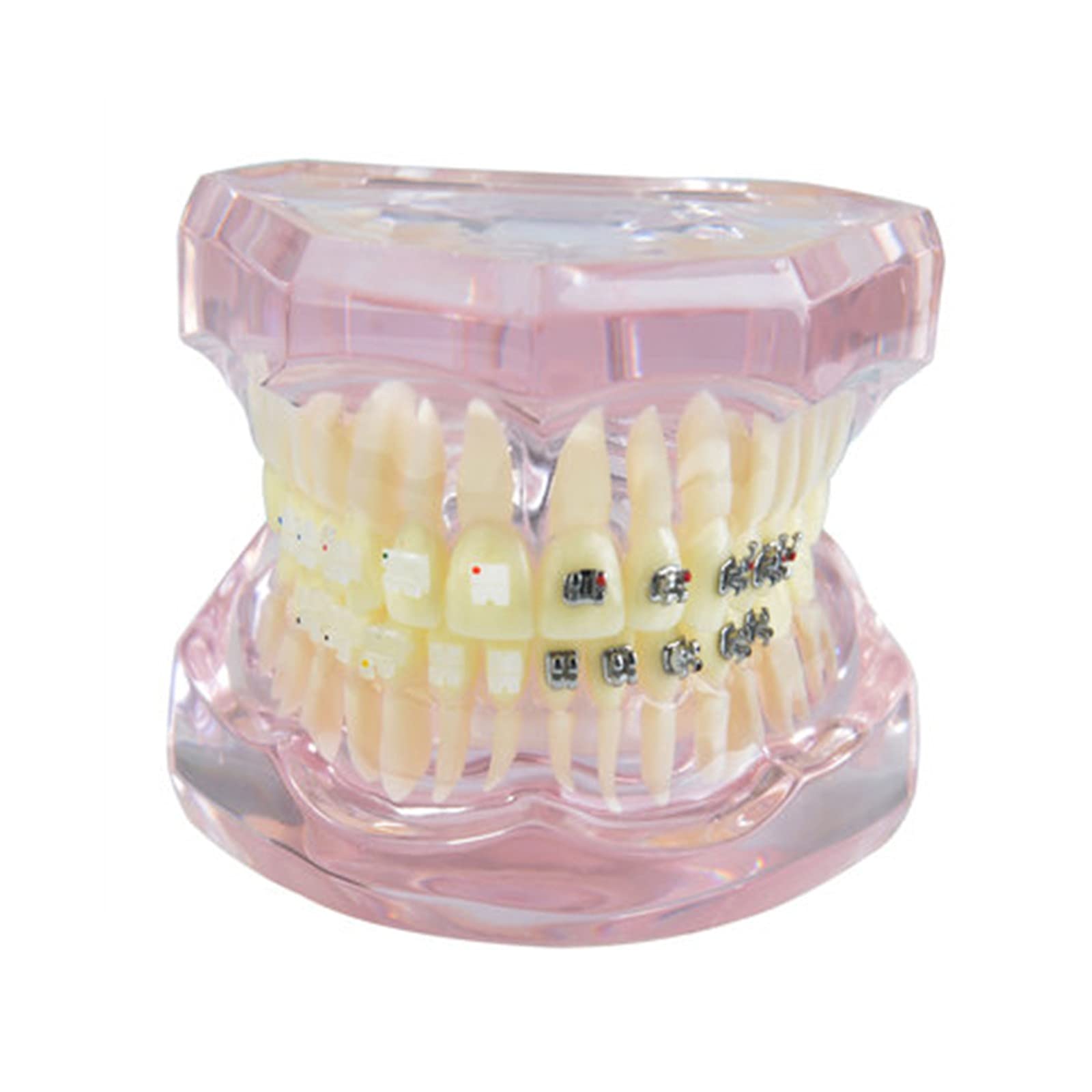 Buy Hsjx Dental Malocclusion Orthodontic Teeth Model Dental Orthodontic ...