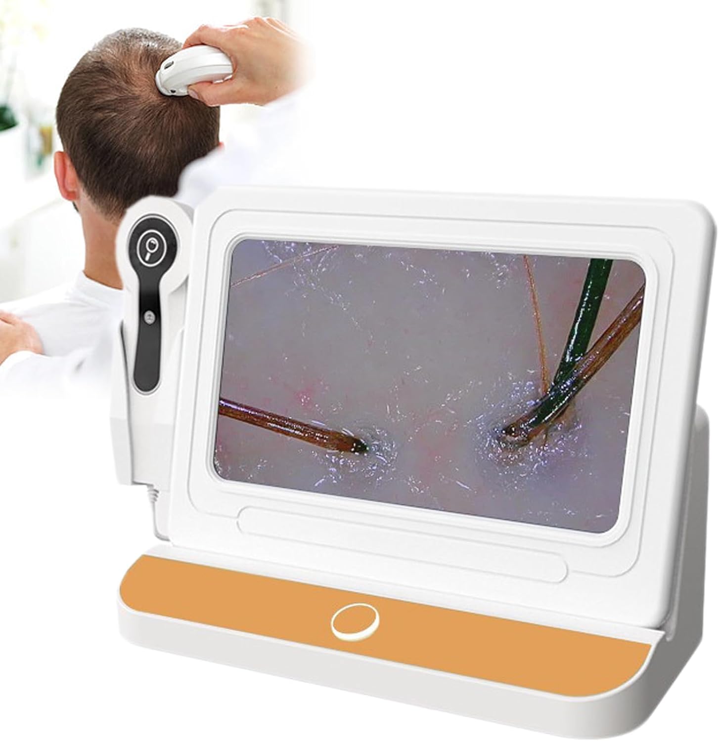 vanenferse 10 Inch Skin Hair Scalp Detector, Skin Diagnosis Hair ...