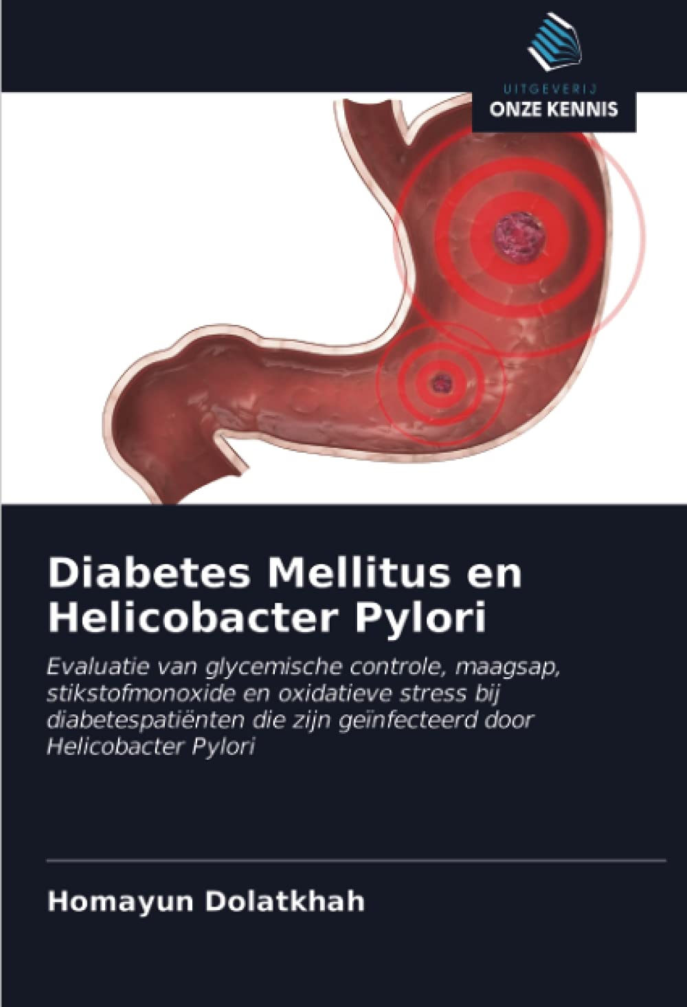 Buy es Mellitus en Helicobacter Pylori: Evaluatie van glycemische ...