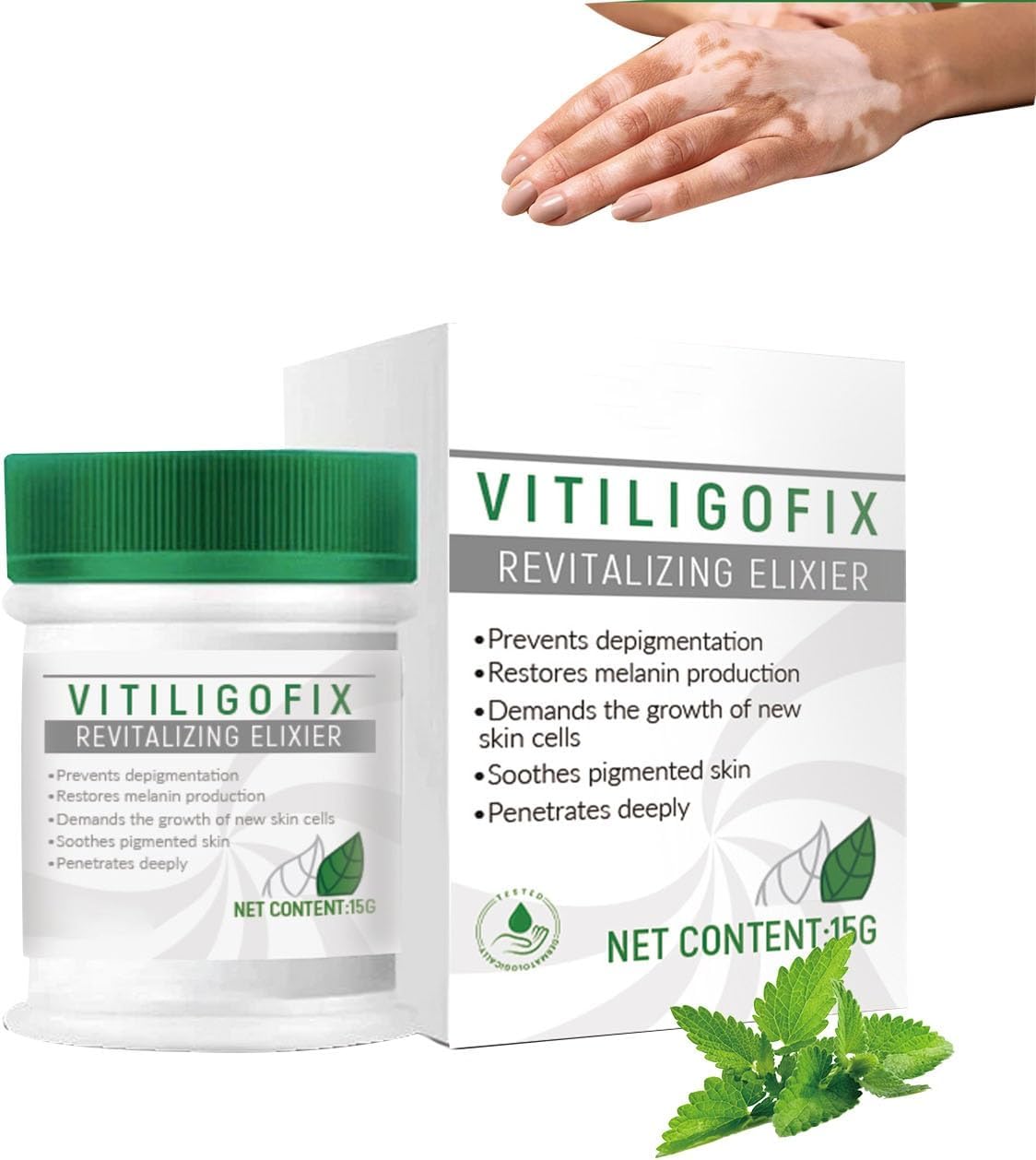 Amazon.com: Crema de tratamiento de vitíligo, elixir revitalizador de ...