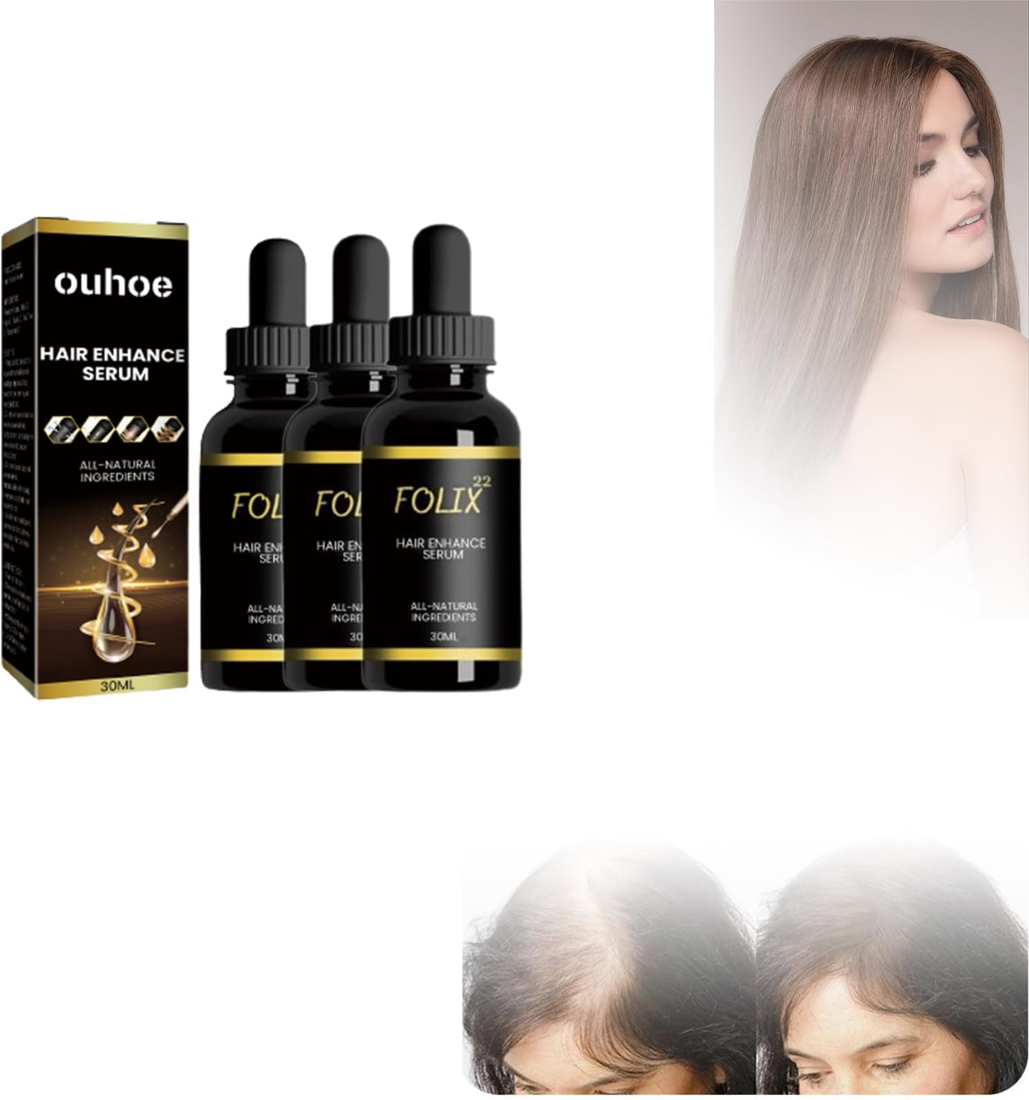 Amazon.com : Folix22 Natural Hair Growth Formula, Regrow Oil, Growth ...