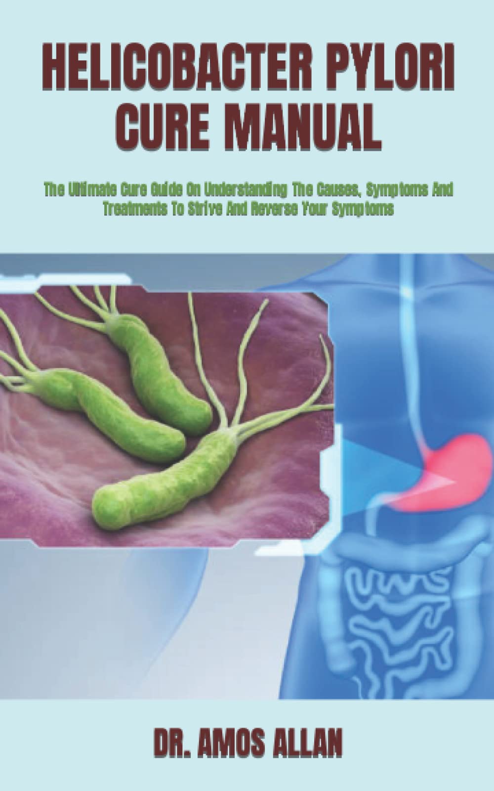 Buy Helicobacter Pylori Cure Manual: The Ultimate Cure Guide On ...