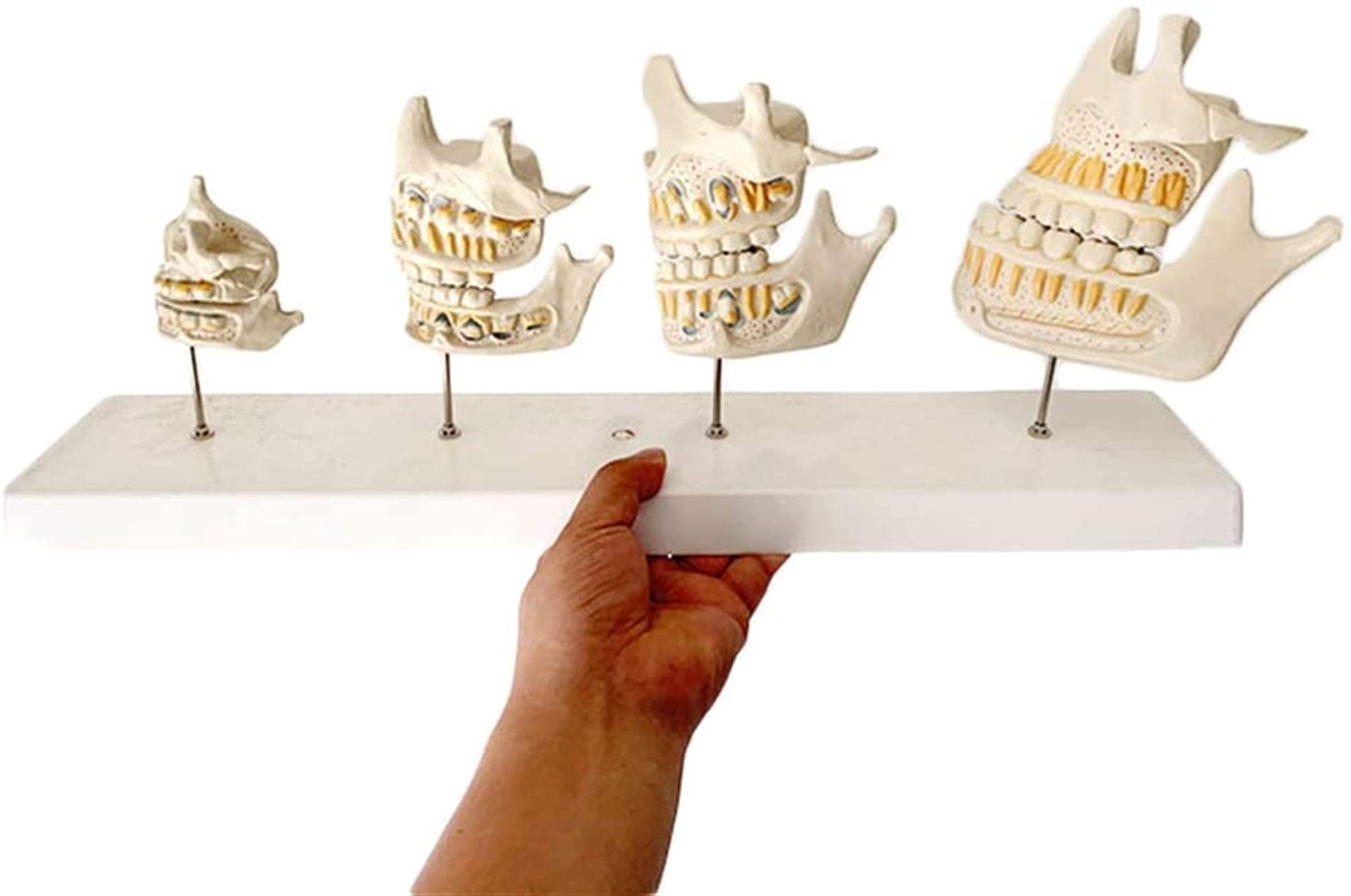 Study Model Dental Teaching Anatomy Model Growth Comparison Series ...