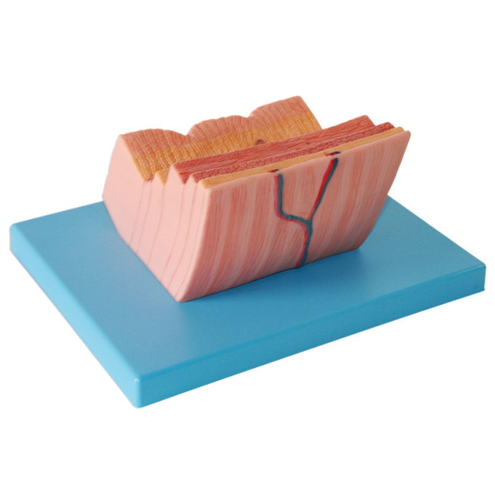 Stomach Wall Model