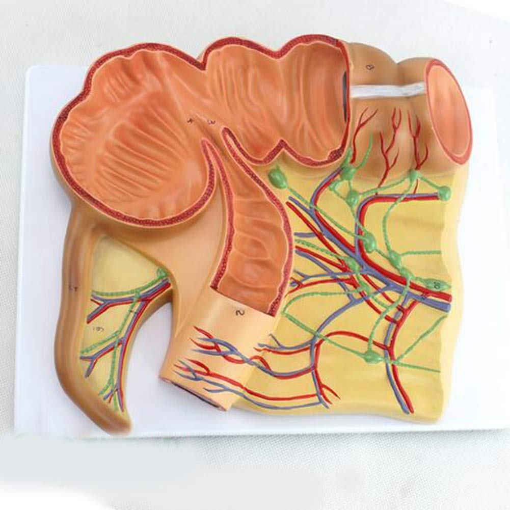 Buy JL Scientific Anatomy Human Rectal Appendix Model Digestive System ...