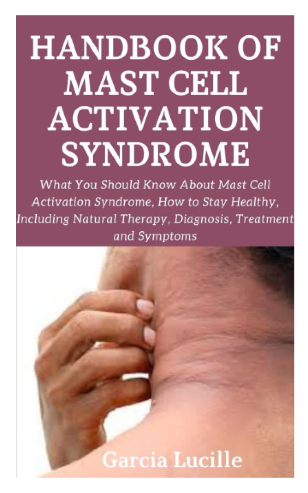 Buy HANDBOOK OF MAST CELL ACTIVATION SYNDROME: What You Should Know ...