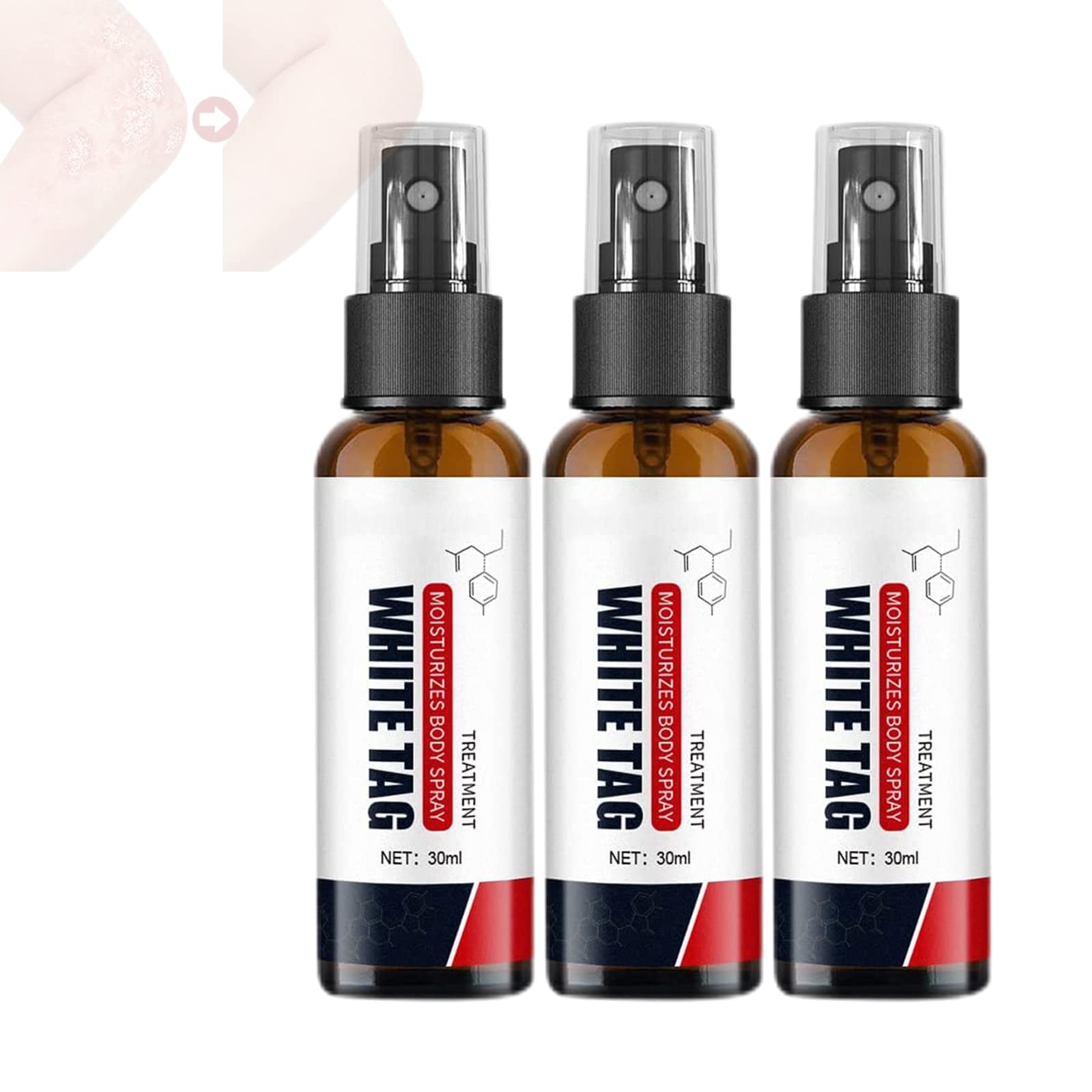 Buy Kolmax Psoriasis Spray - Dermax Psoriasis Spra,Psoriasis Spray ...