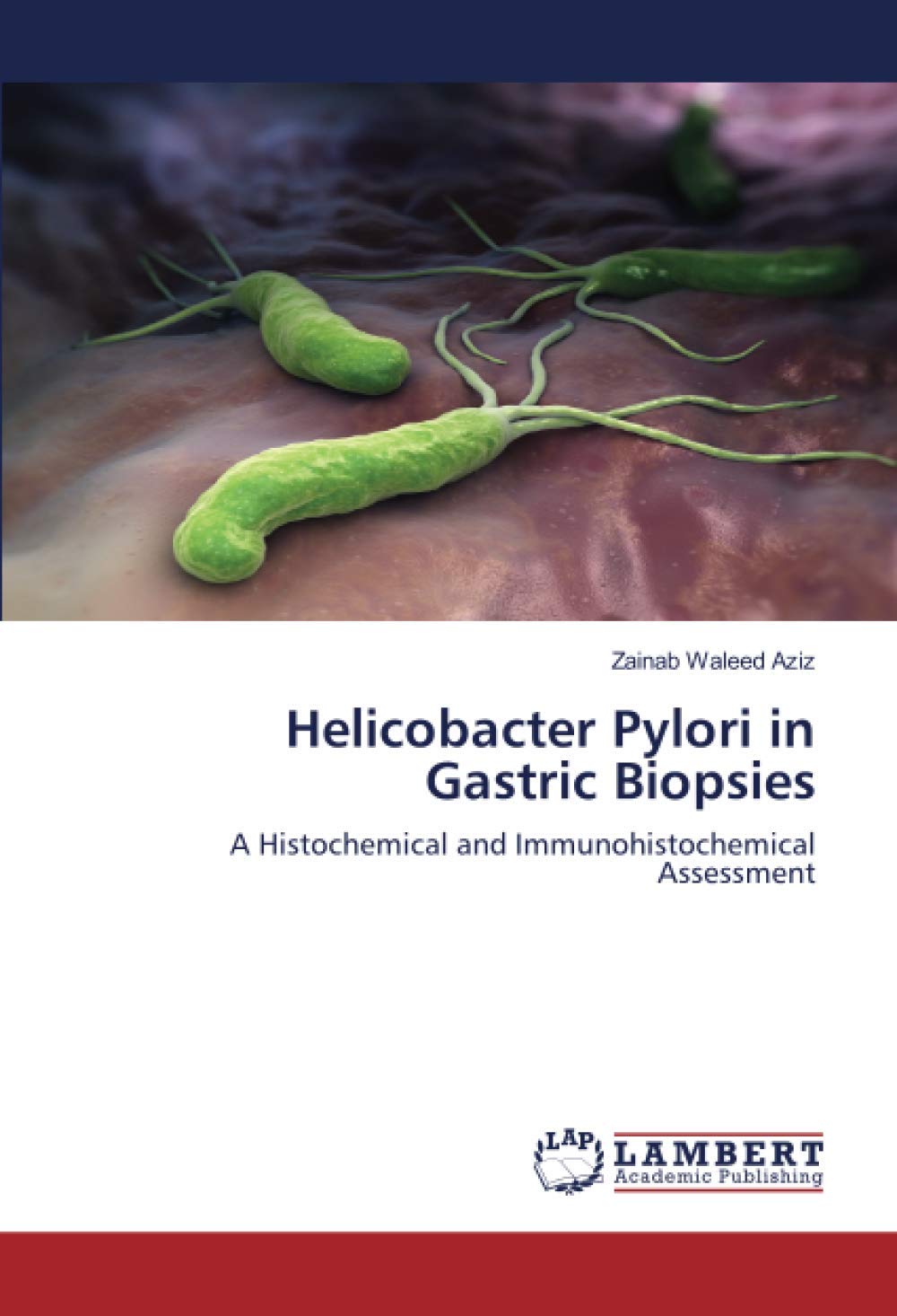 Buy Helicobacter Pylori in tric Biopsies: A Histo and Immunohisto ...