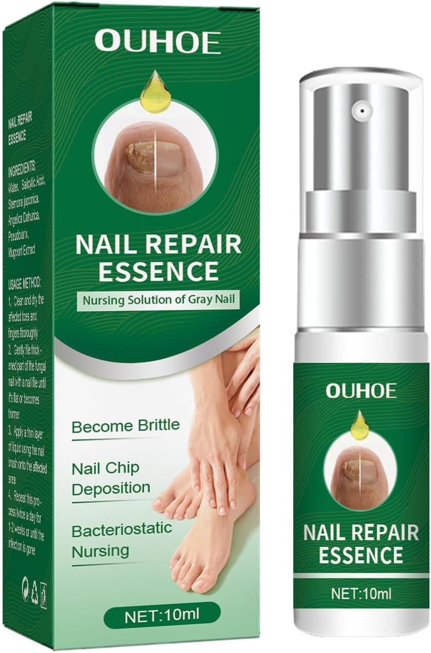 Ingrown Toenail Drop, German Toenailcare Removal Paronychia Oil,Toenail ...