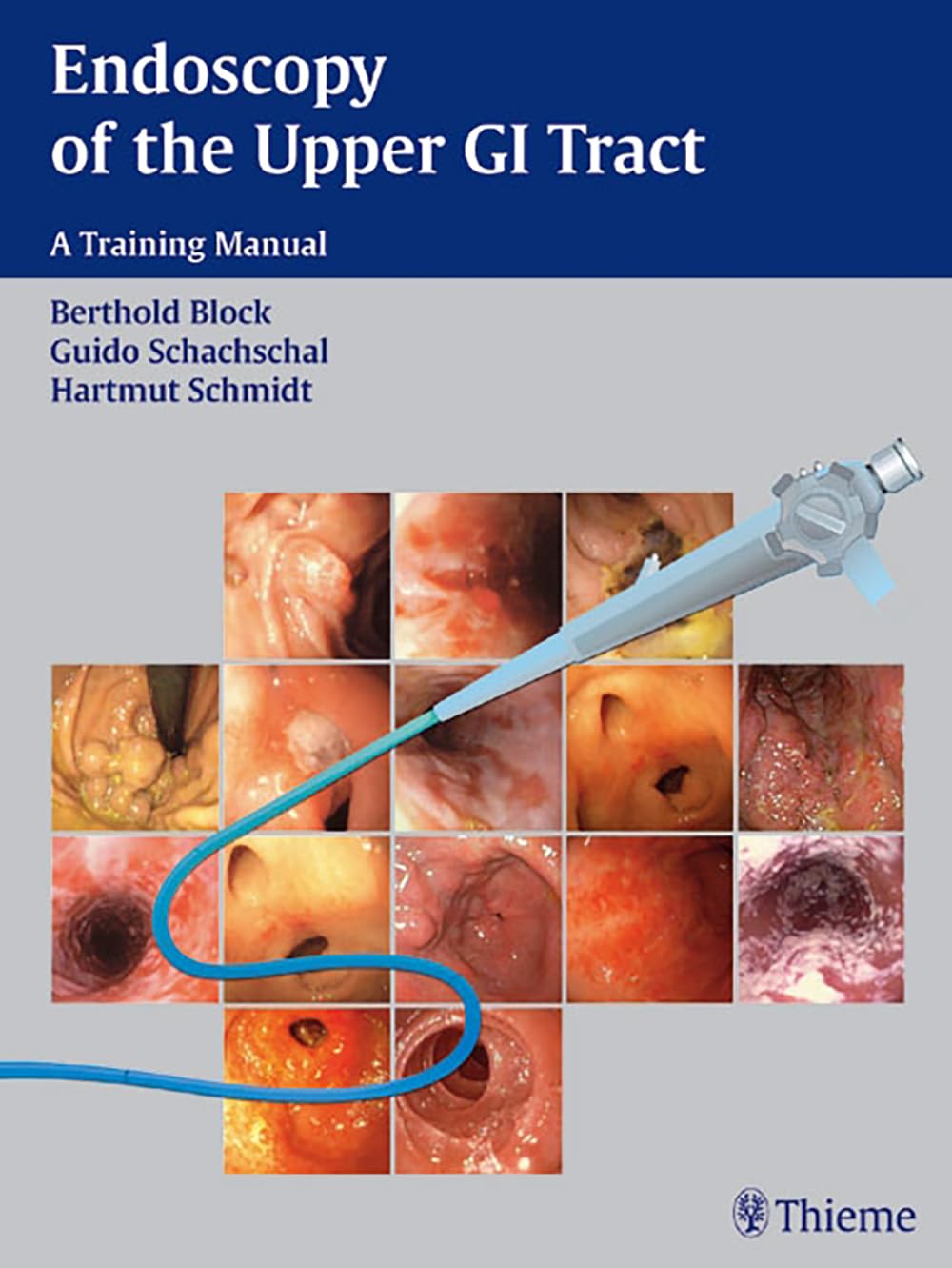 Snapklik.com : Endoscopy Of The Upper GI Tract: A Training Manual