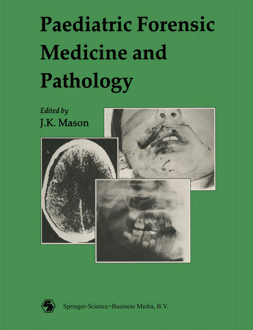 Paediatric Forensic Med & Path: 9780412291609: Medicine & Health ...
