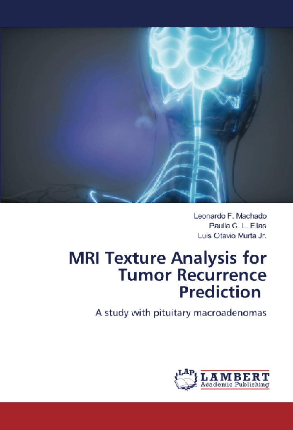 Buy MRI Texture Analysis for Tumor Recurrence Prediction: A study with ...