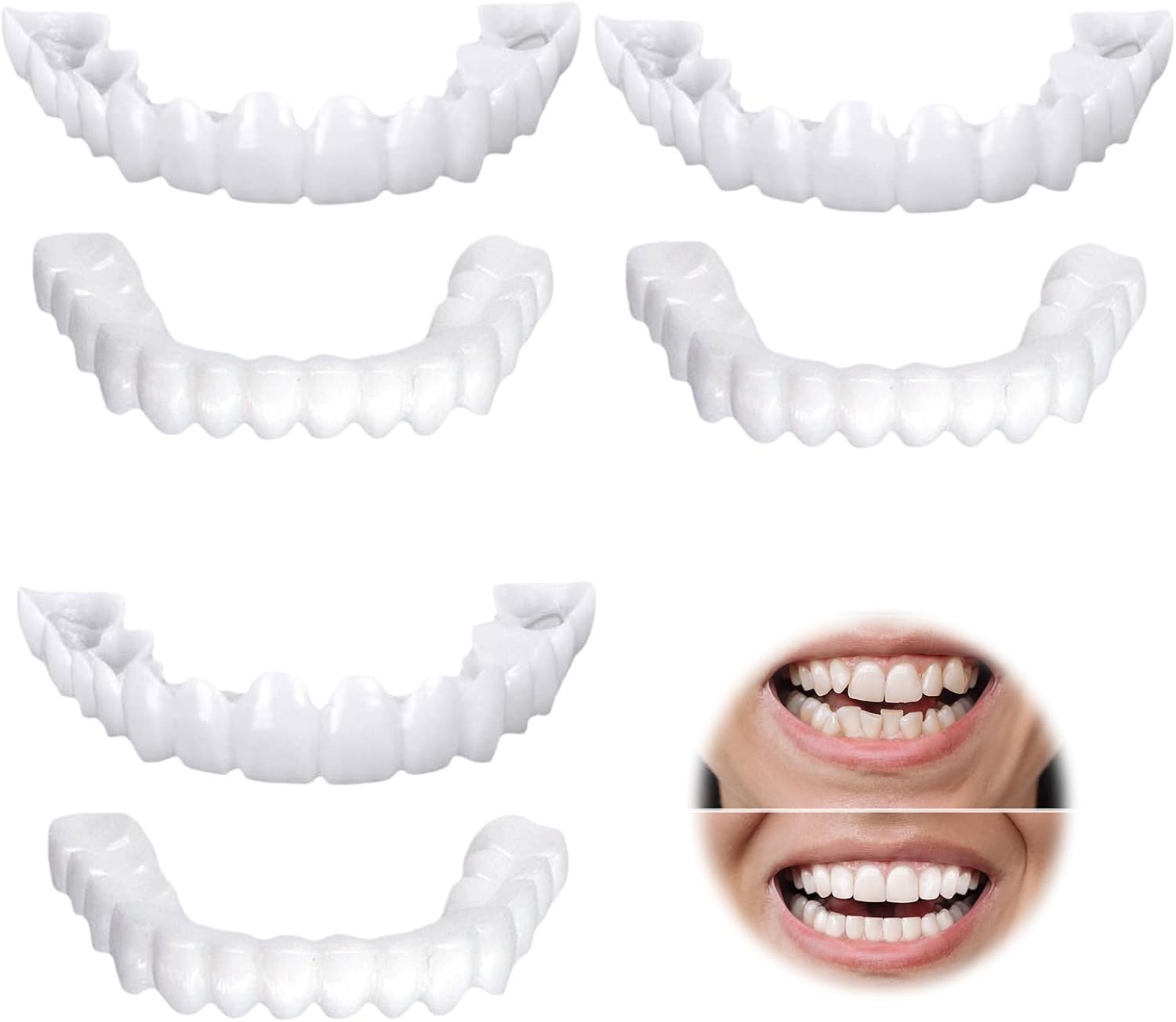 Ninnyi 3 Pairs Clip in Veneers Teeth, Instant Snap on Dentures Top and ...