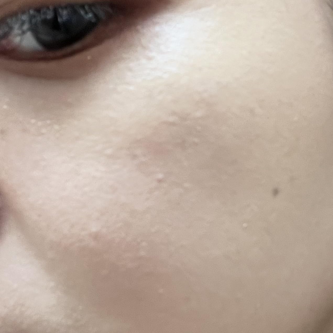 Amazon | コジット CICA method RECOVER PATCH | コジット | 部分パック 通販