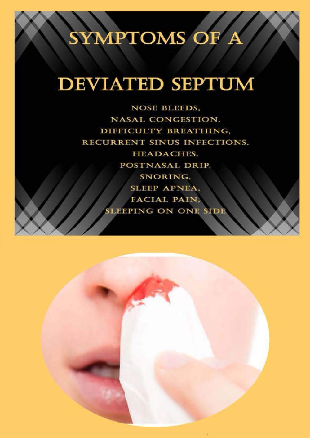 Symptoms Of A Deviated Septum Nose Bleeds Nasal Congestion Difficulty ...