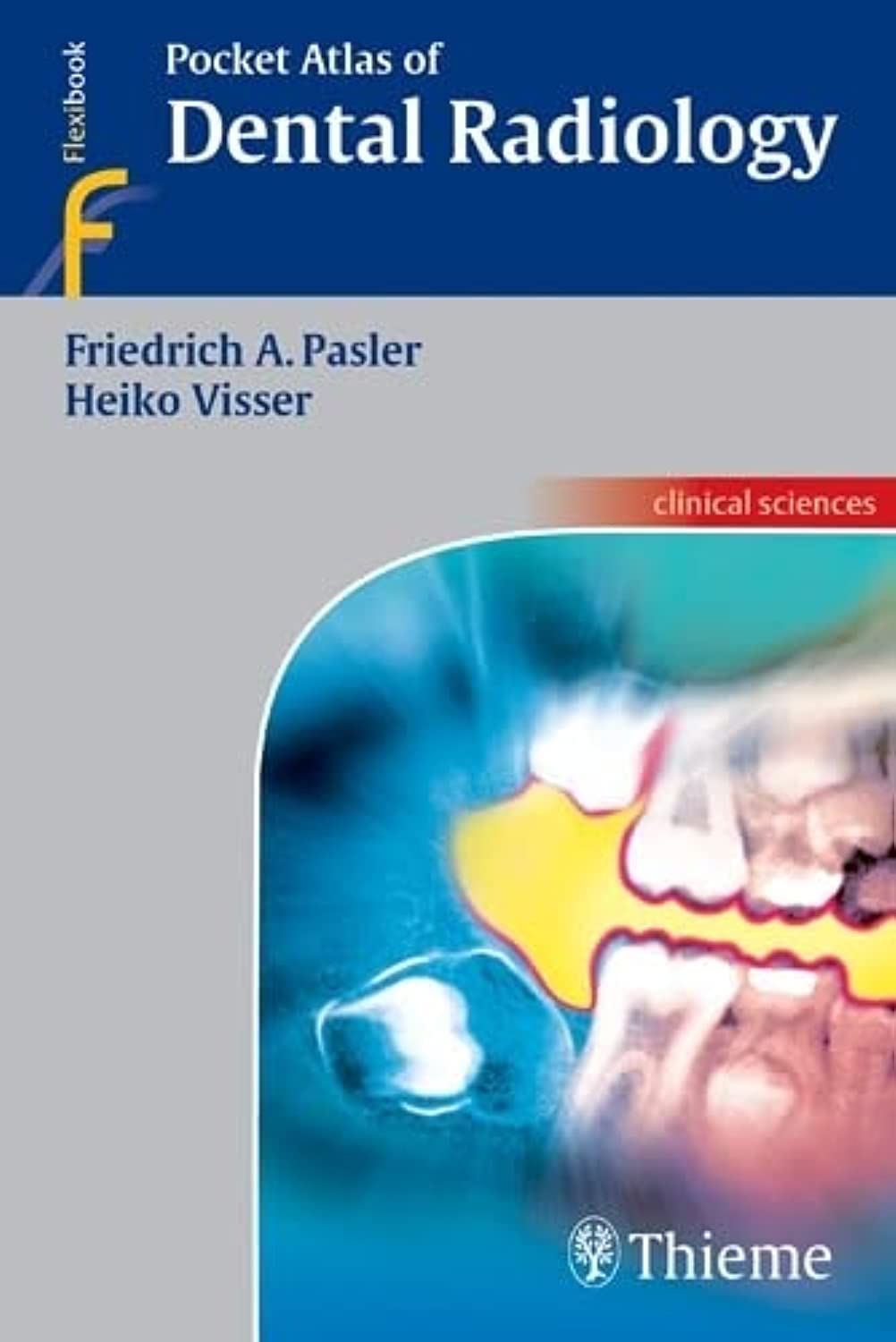 Pocket Atlas of Dental Radiology: 9783131398017: Medicine & Health ...