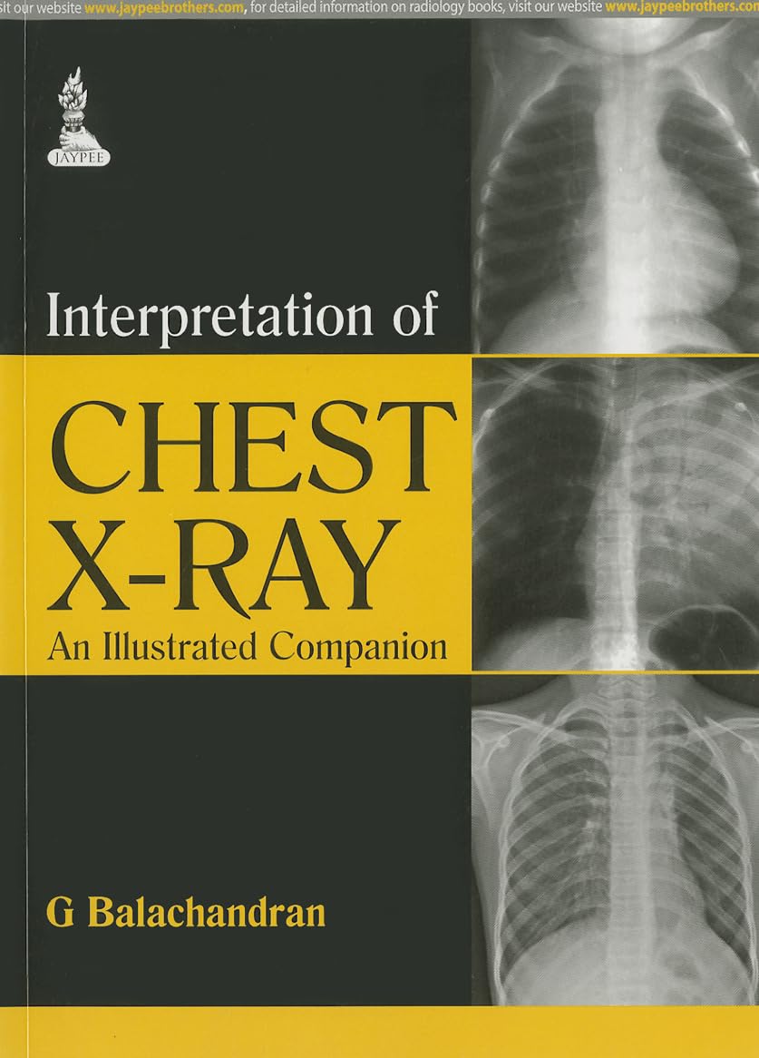 Interpretation of Chest X-Ray: An Illustrated Companion: 9789351521723 ...
