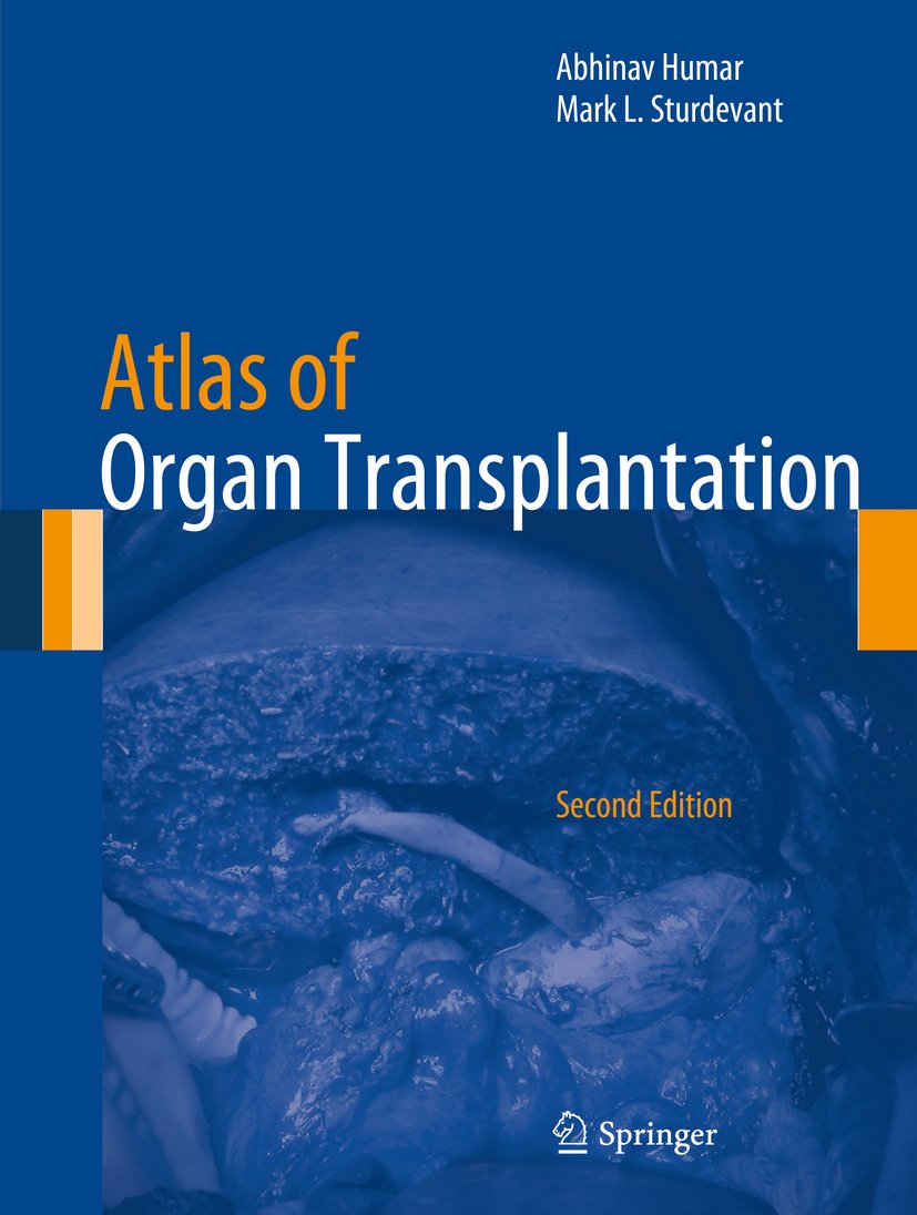 Amazon | Atlas of Organ Transplantation (English Edition) [Kindle ...