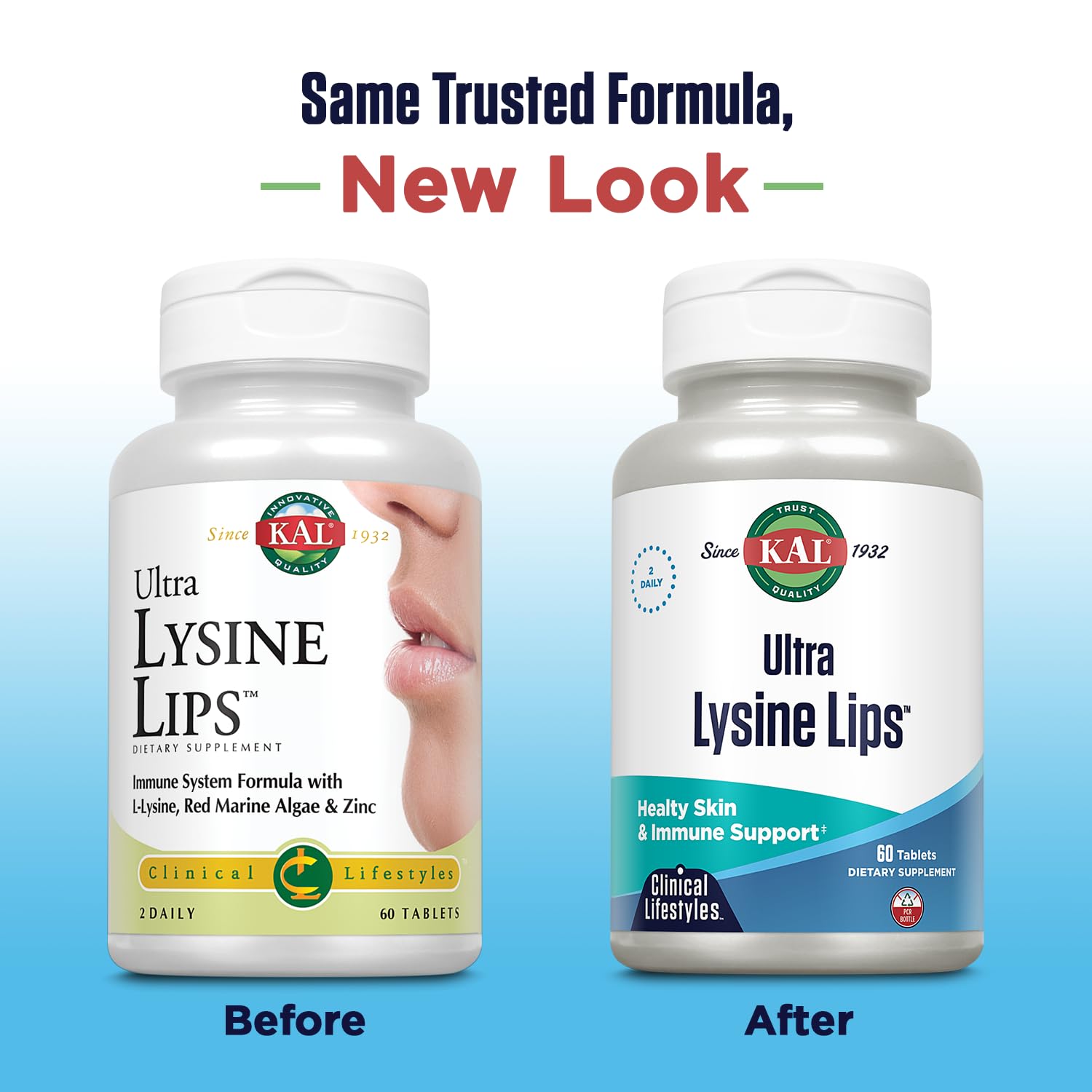 Snapklik.com : KAL Ultra Lysine Lips Supplement Tablets - 1500 Mg Of L ...