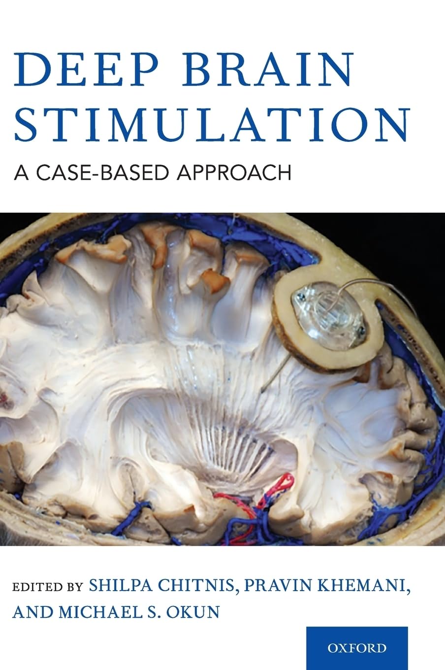 Deep Brain Stimulation: A Case-based Approach: 9780190647209: Medicine ...