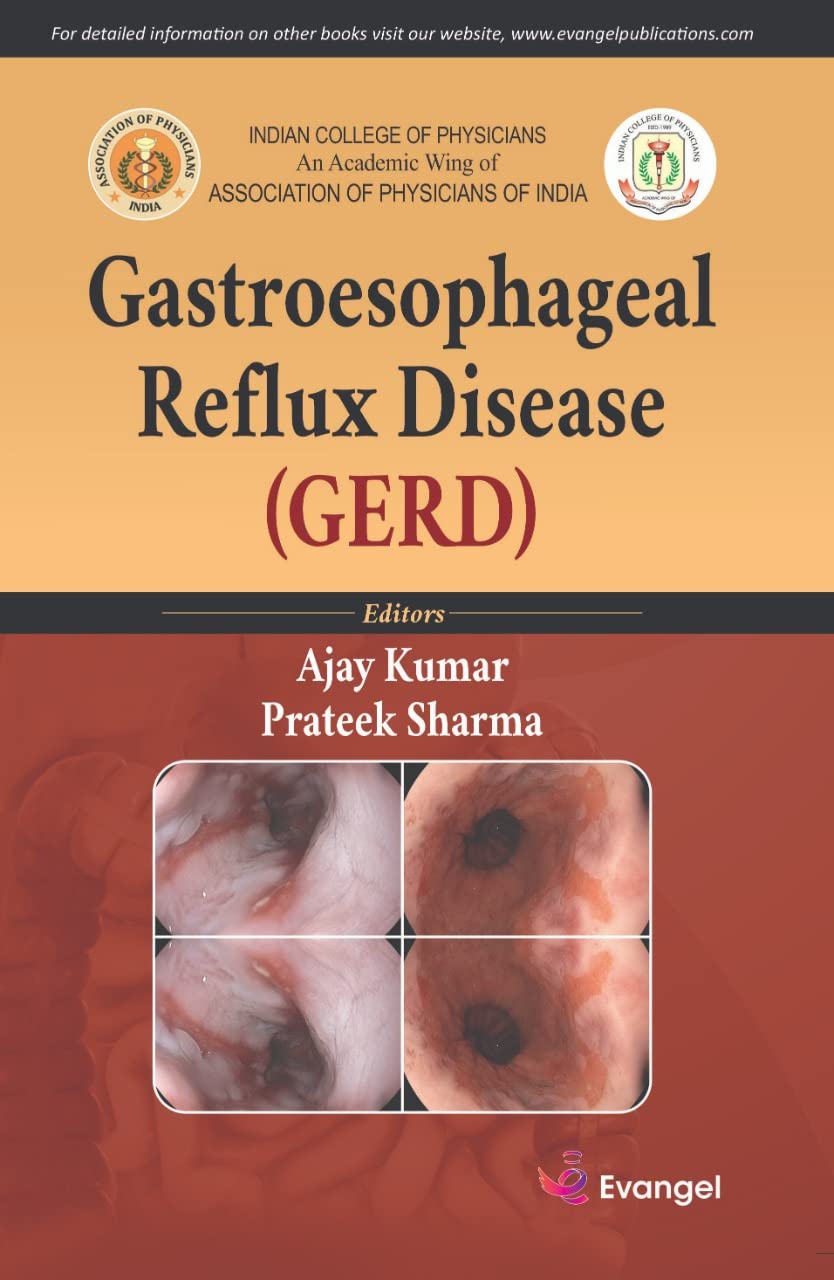 Buy Gastroesophageal Reflux Disease (GERD) Book Online at Low Prices in ...