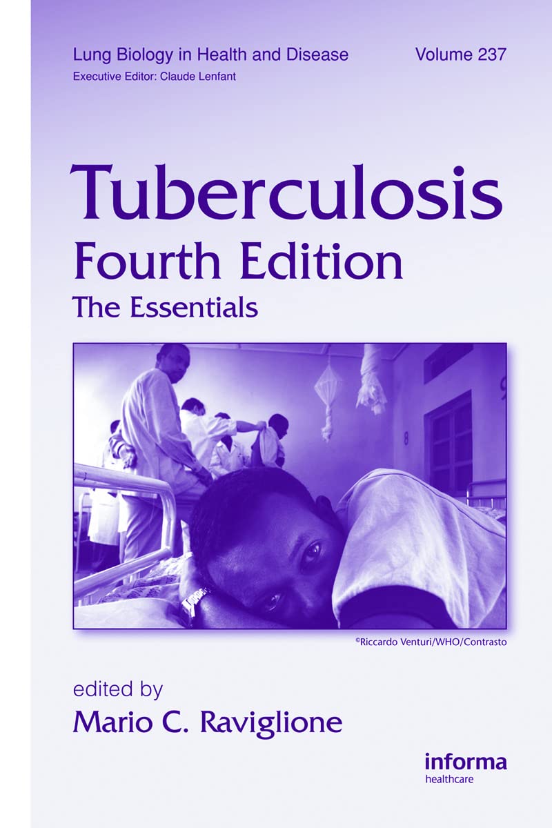 Tuberculosis: The Essentials, Fourth Edition (Lung Biology in Health ...