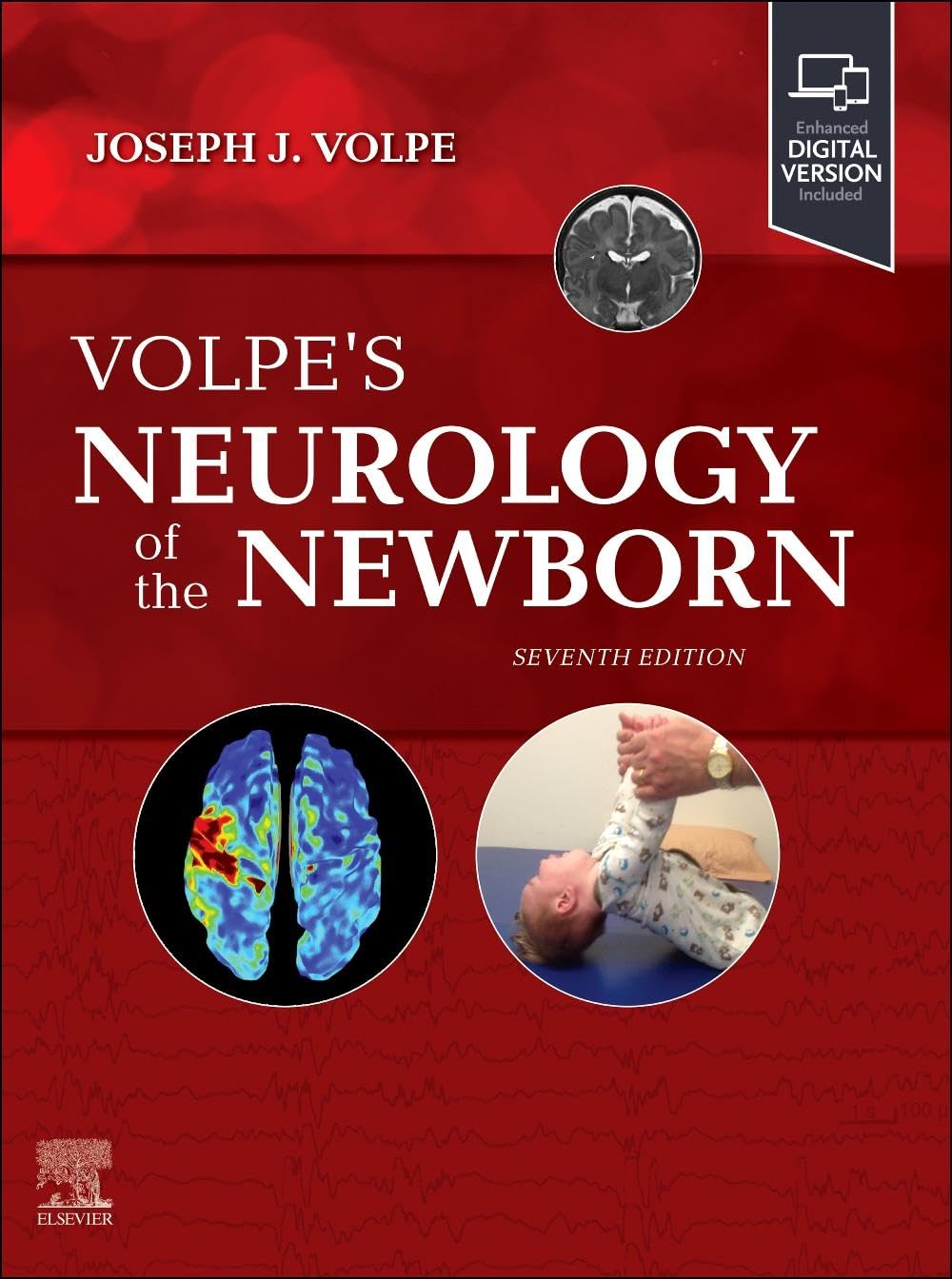 Amazon | Volpe's Neurology of the Newborn | Volpe MD, Joseph J., Inder ...