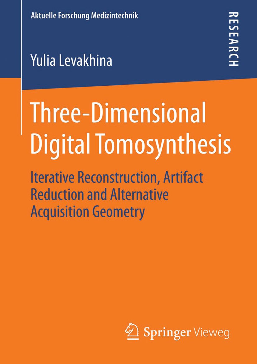 Three Dimensional Digital Tomosynthesis Iterative Reconstruction