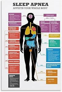 Amazon.com: Sleep Apnea Infographic Poster Sleep Apnea Guide Poster ...