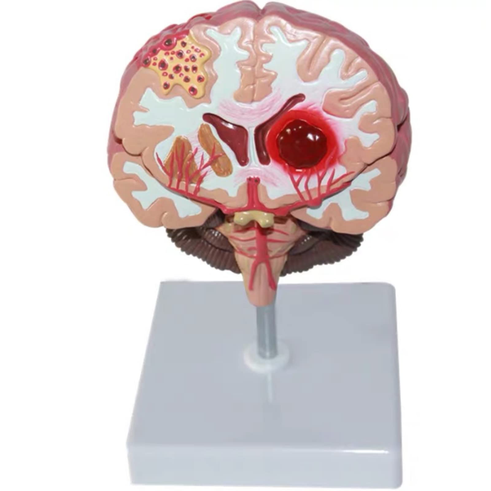 Buy Brain Pathological Model Human Anatomical Brain Model Malformed ...