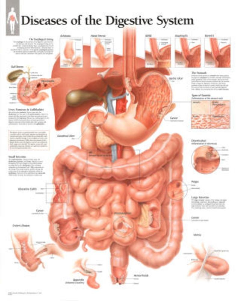 Snapklik.com : Diseases Of Digestive System Chart: Wall Chart